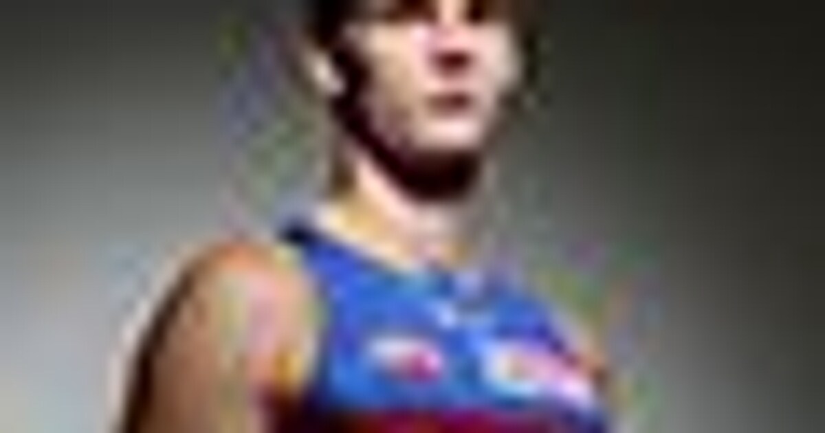 Scans reveal extent of Skinner's injury