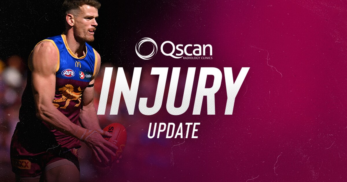 Qscan Injury Update: Scans reveal fracture for Joyce